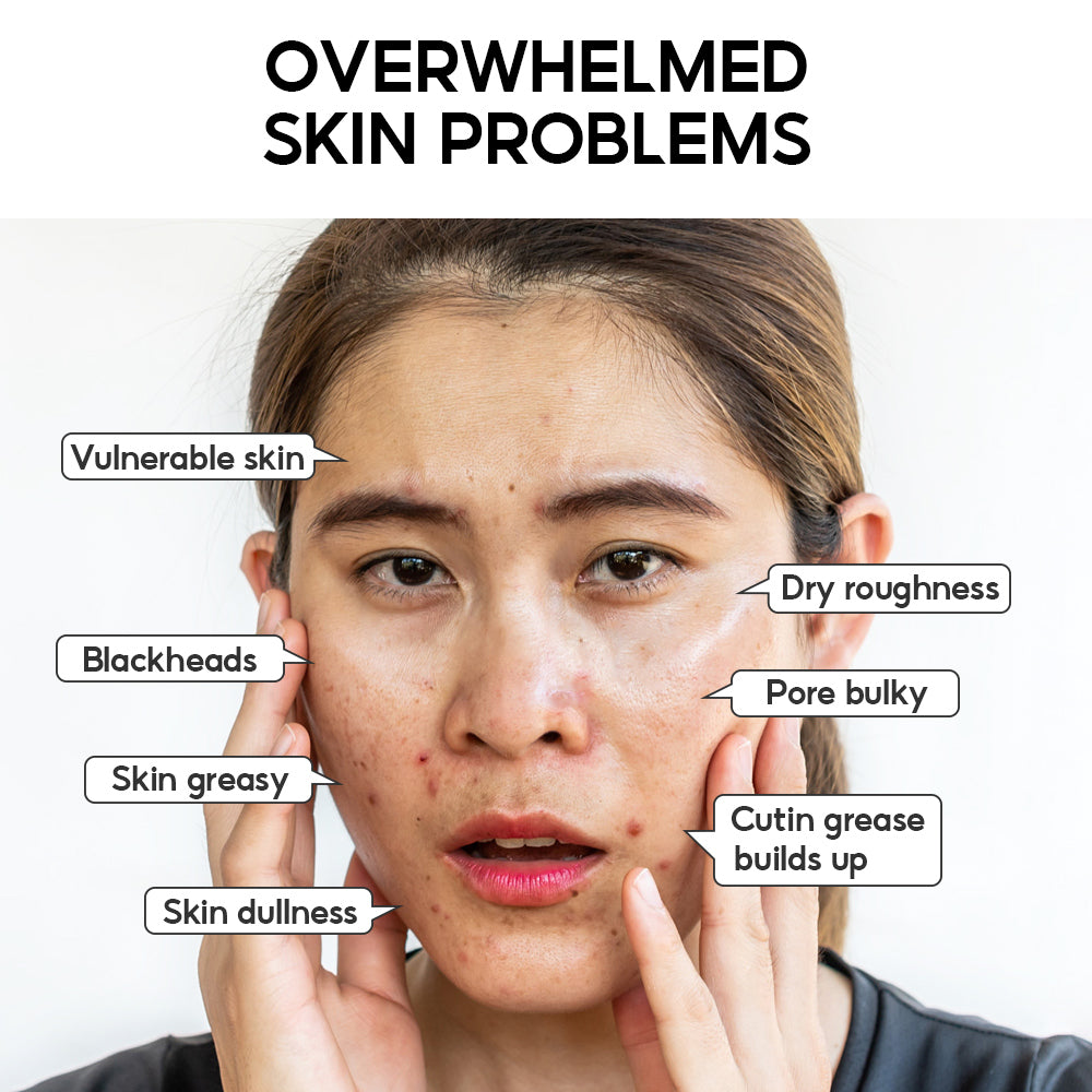 VIBRANT GLAMOUR Gel & Mud Mask Retinol Anti-aging Salicylic Acid Tea T ...